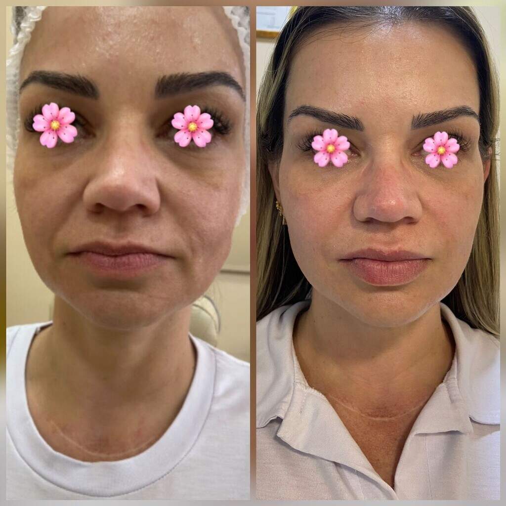 A Royal Face está com protocolos imperdíveis a partir de R$ 699