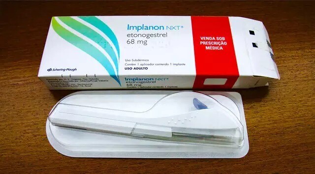 Chip contraceptivo no SUS: como funciona e como conseguir