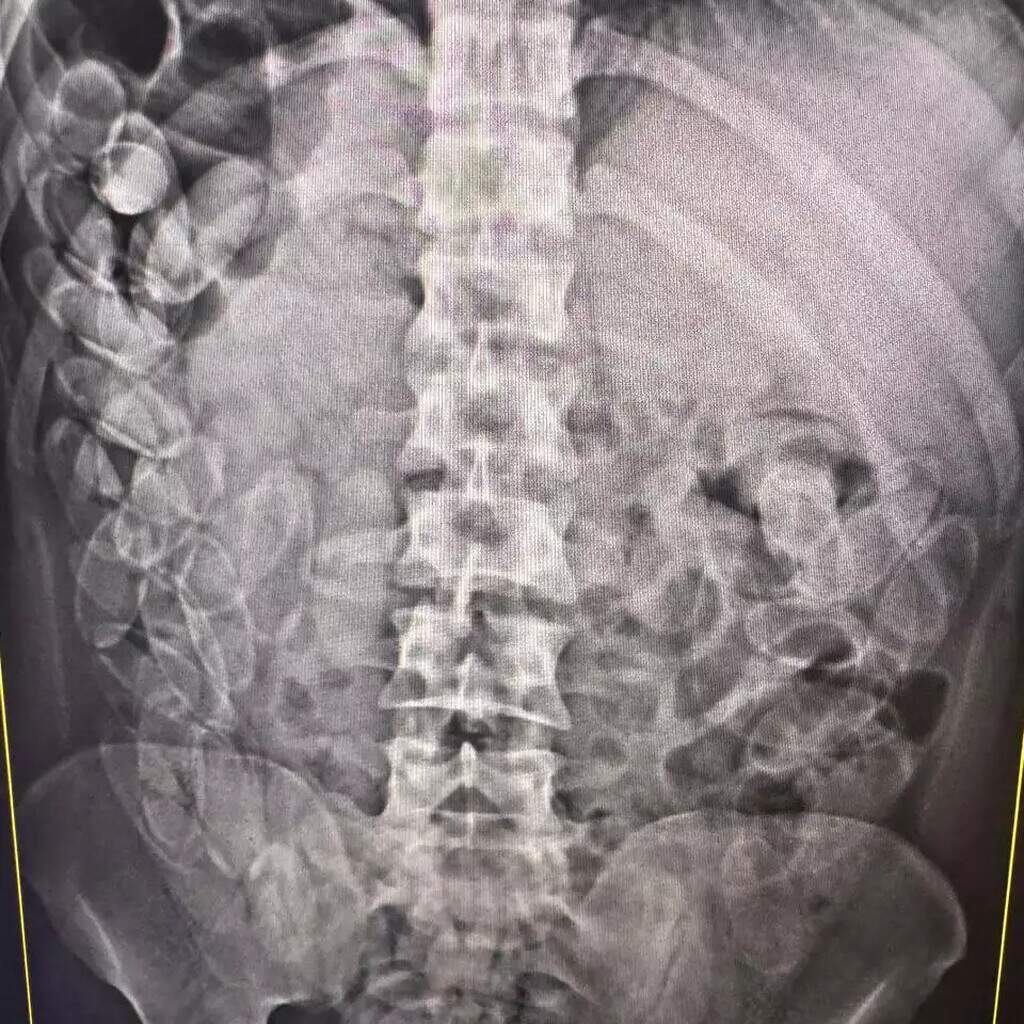 PCC transforma Corumbá em rota da cocaína com 'mulas' em escala industrial